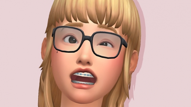 EA Colored Braces at Rinvalee » Sims 4 Updates