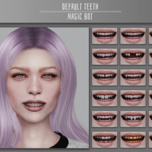 EA Colored Braces at Rinvalee » Sims 4 Updates